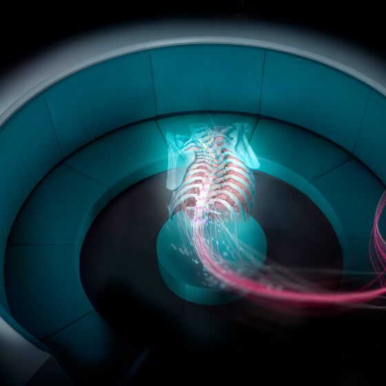 Spinal Navigation: Digitalizing Spine Surgery | Brainlab